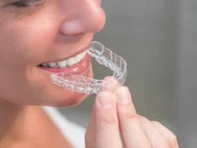 5 Tips to Consider When Choosing Invisalign Treatment - Pezoldt ...